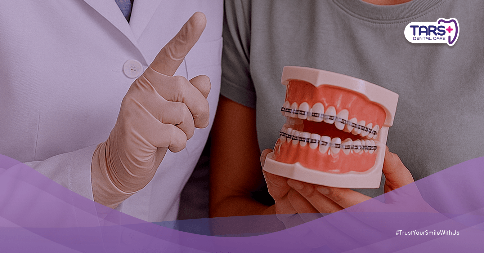 Jenis Behel yang Populer di Indonesia: Kelebihan dan Kekurangannya